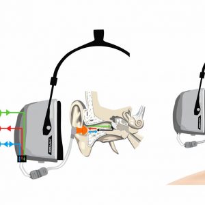 A complete guide to tympanometry | Ear Cleaning Clinic