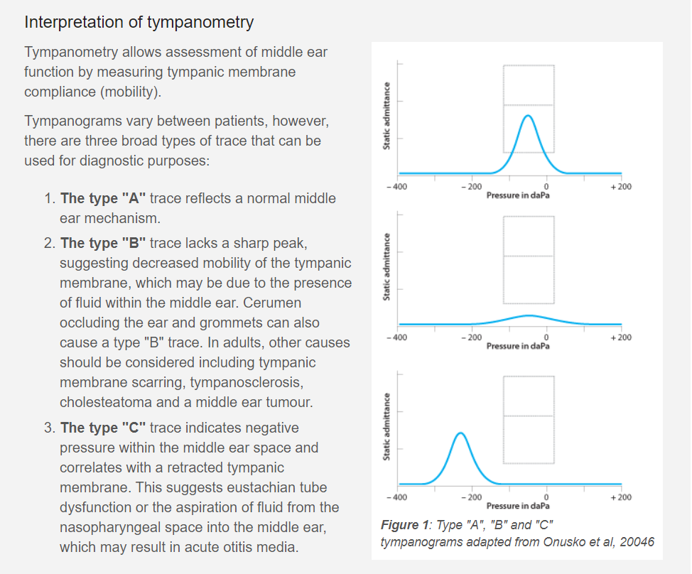 A Guide to Tympanometry - Ear Cleaning Clinic